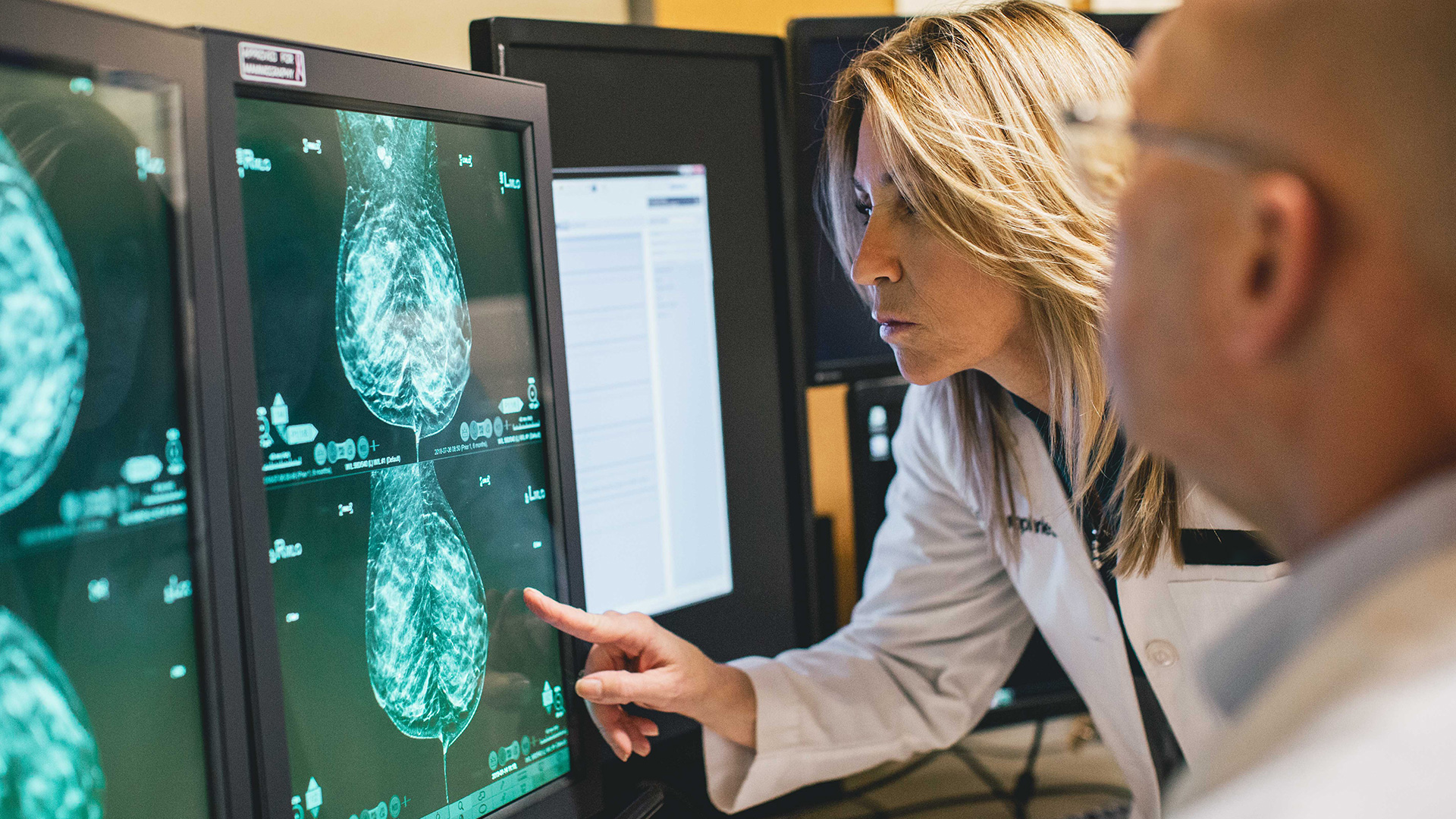 4 Things to Know About the USPSTF New Draft Guidance for Mammograms ...